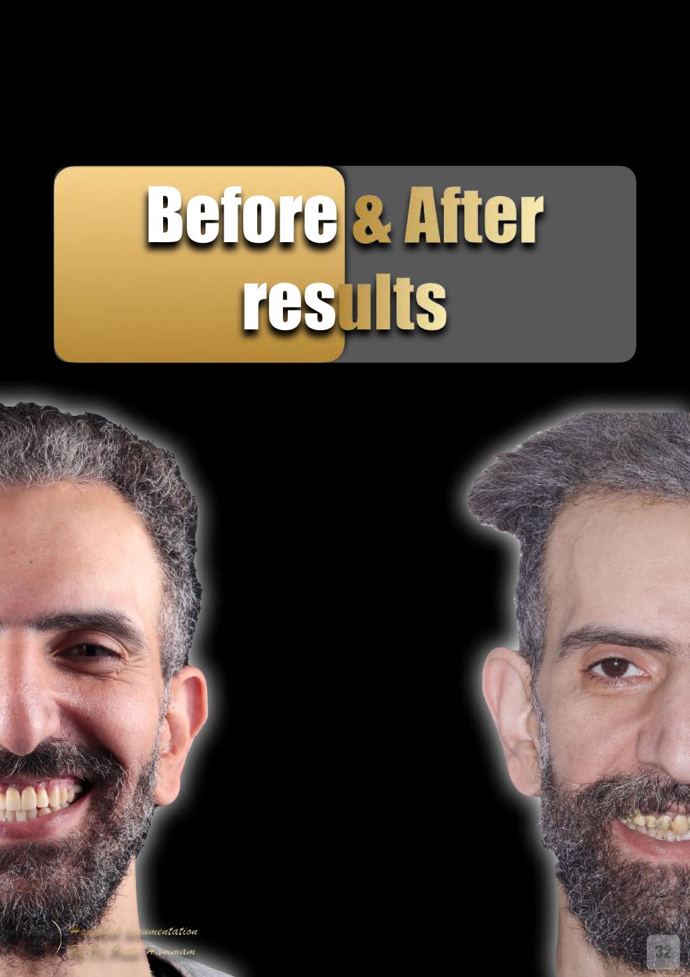 Part 6 (Before & After) | PDF to Flipbook