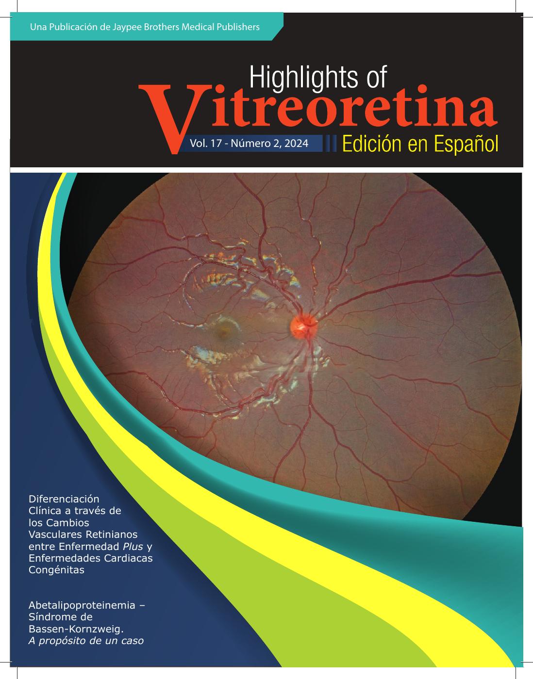 Highlights of VitreoRetina