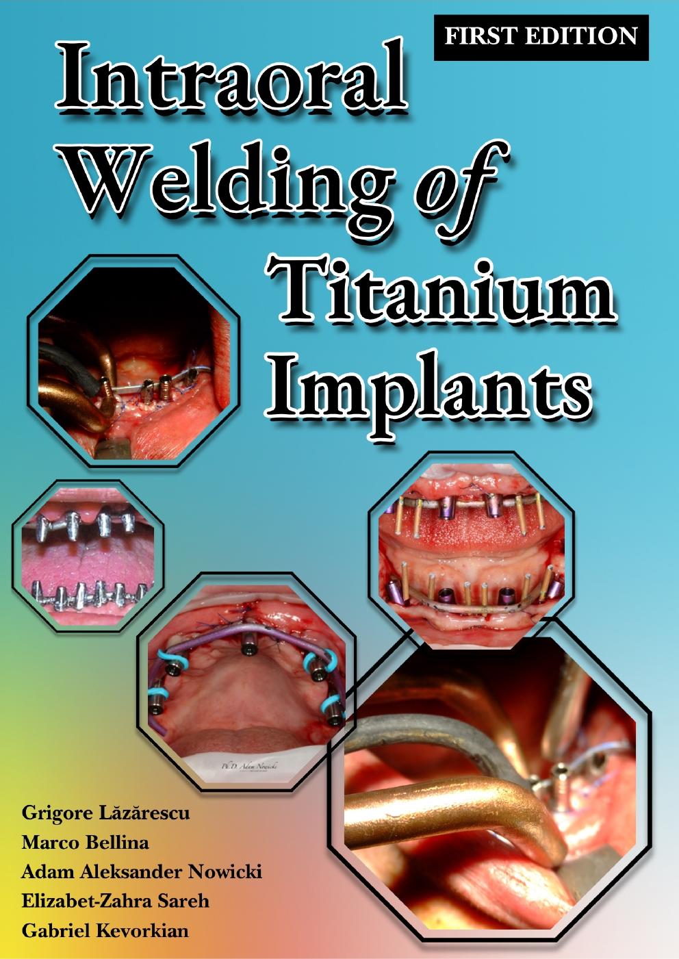 Intraoral Welding of Titanium Implants | PDF to Flipbook